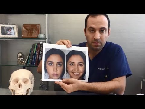 Eye Asymmetry Evaluation and Treatment Guide by Dr. Taban - YouTube