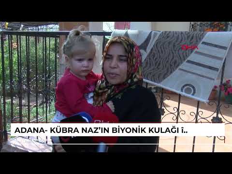 Adana- Kübra Naz’ın biyonik kulağı çalındı; annesi: Bizi duysun, konuşsun istiyorum