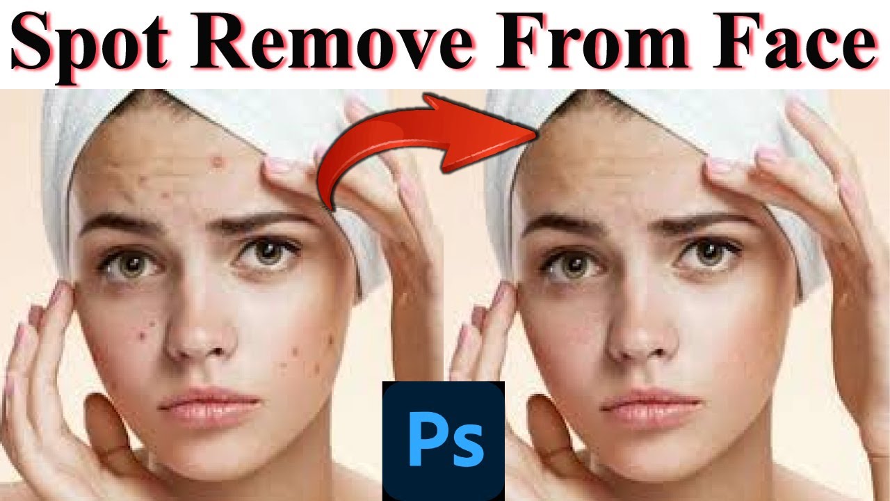 Remove Spot In Photoshop Bangla Tutorial Spot Remove In Photoshop Bangla Tutorial Bangla remove-spot-in-photoshop-bangla-tutorial-spot-remove-in-photoshop-bangla-tutorial-bangla