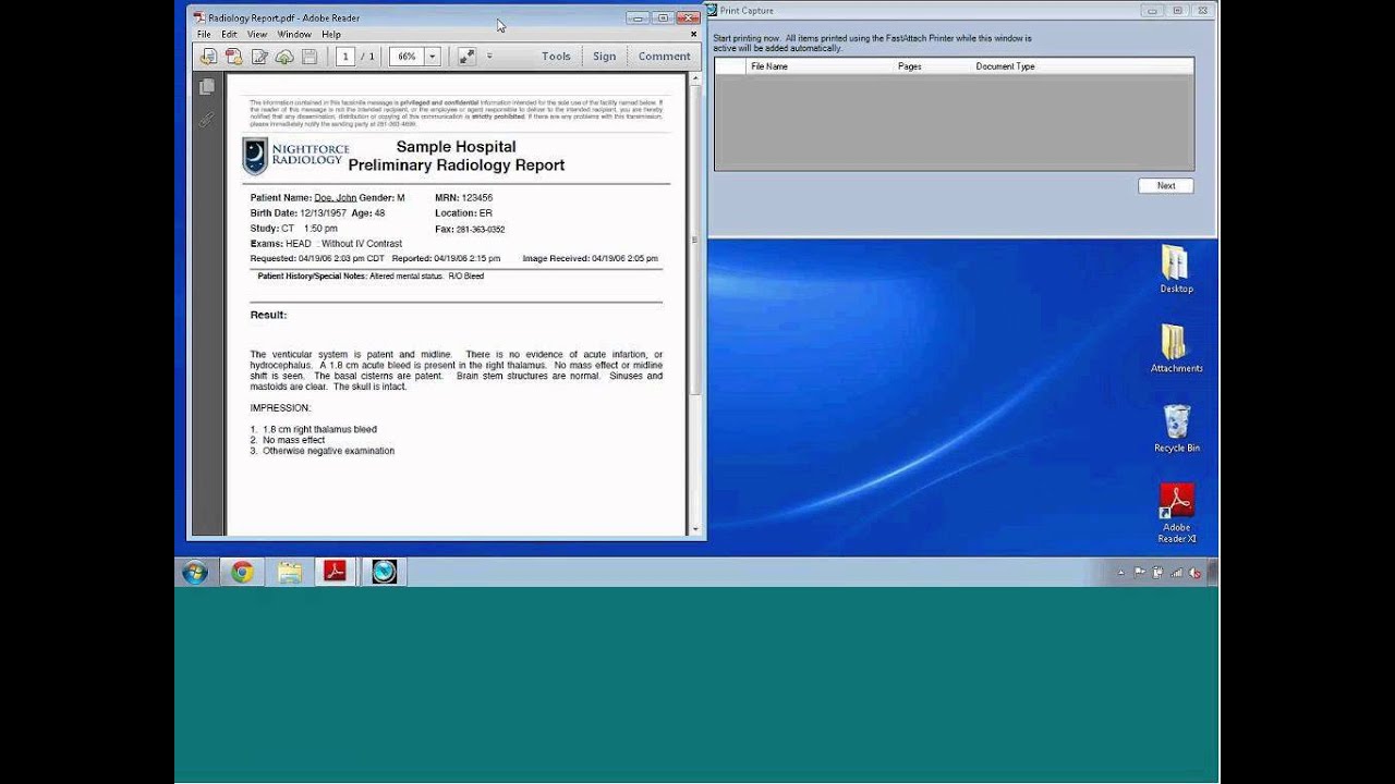 MEA FastAttach DSG Demo - YouTube