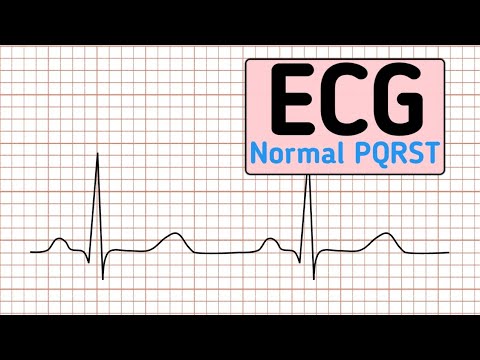 Normal ECG में pqrst wave क्या है? कैसे बनती हैं? और इनका क्या अर्थ है ...