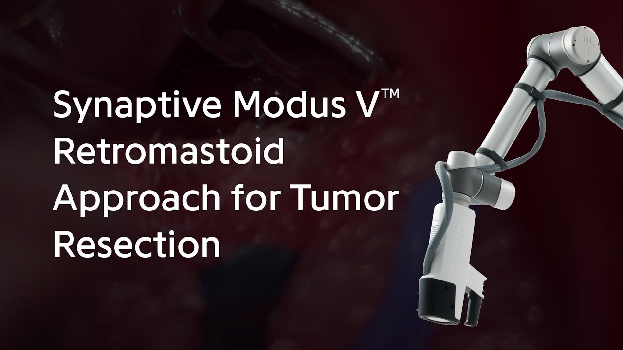 Synaptive Modus V™ Retromastoid Approach for Tumor Resection - YouTube