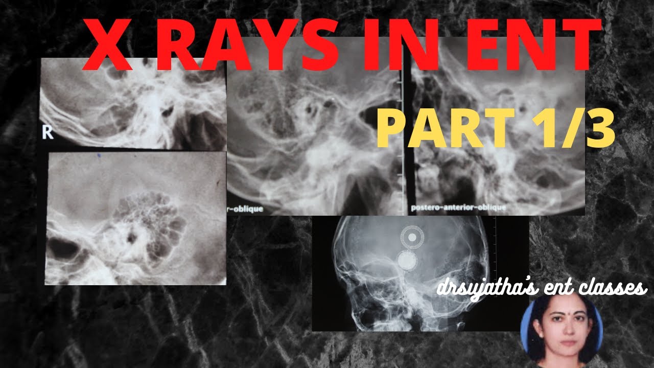 100. X ray classes for ENT Undergraduates Part 1/3 #medicalstudent # ...