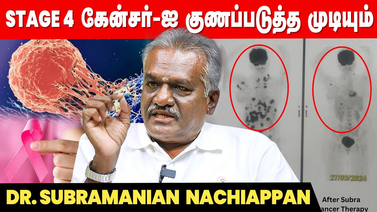 Stage 4 Cancer -ஐ குணப்படுத்த முடியும்.! - Dr. Subramanian Nachiappan ...