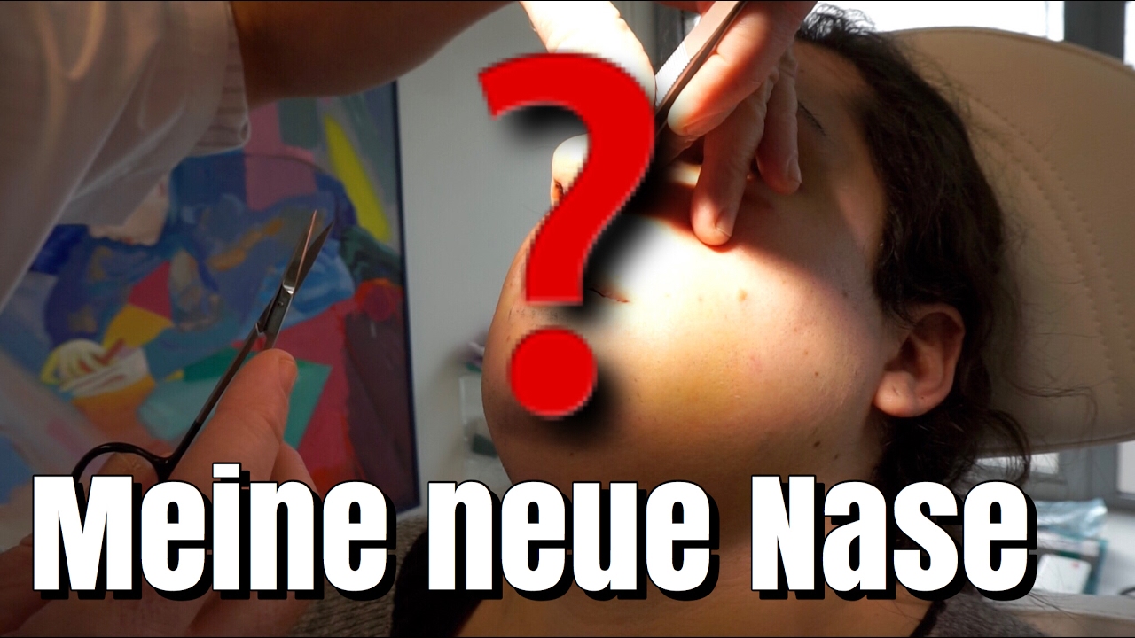 MEINE NEUE NASE & FFS OPERATION | TACKER & FÄDEN ZIEHEN | Jolina Mennen ...