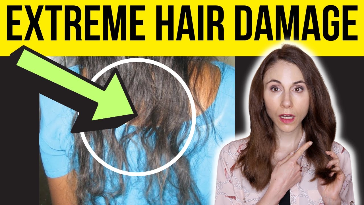 EXTREME HAIR DAMAGE FROM HEAT | Dermatologist @DrDrayzday - YouTube
