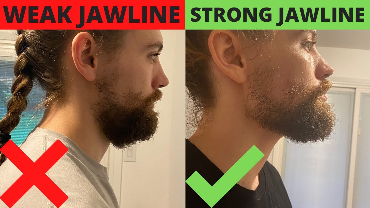Weak Jawline Beard