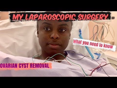 OVARIAN CYST/ LAPAROSCOPIC SURGERY | WHAT YOU NEED TO KNOW - YouTube