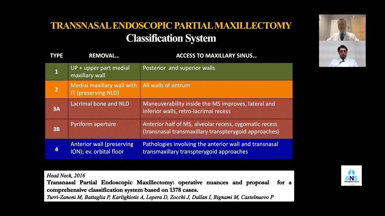 Transnasal endoscopic maxillectomy: classification, indications - YouTube