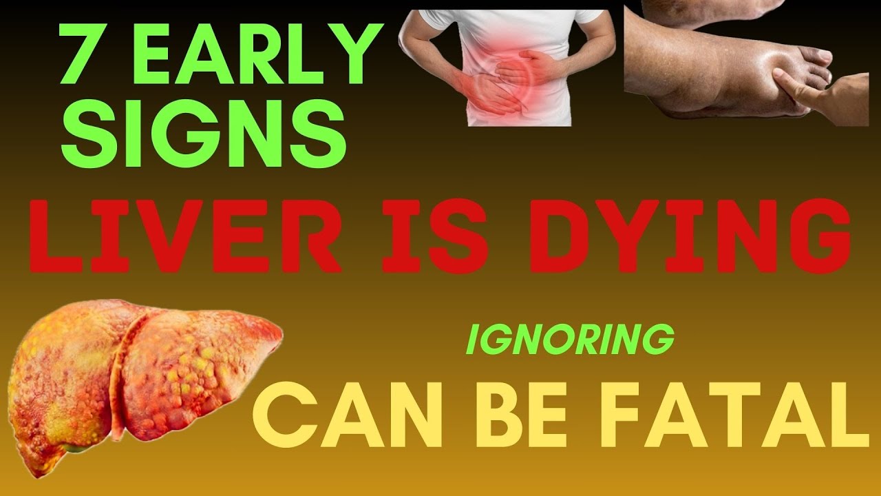 Seven Early signs that you might be having a fatty liver, ignoring ...