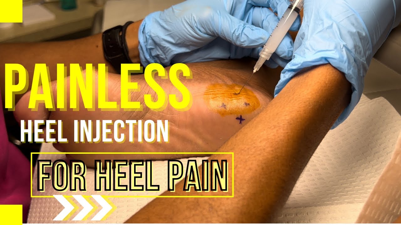 PAINLESS HEEL INJECTION FOR HEEL PAIN - YouTube