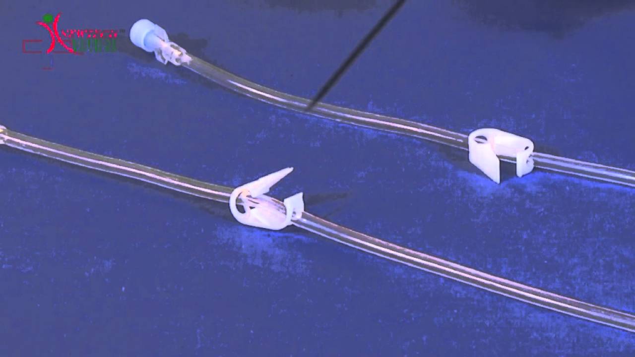 FISTULA NEEDLE - YouTube