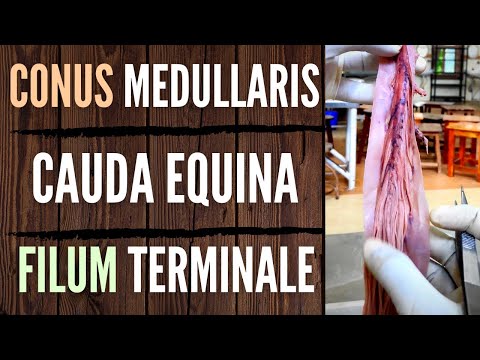 What Is Filum Terminale Of Spinal Cord