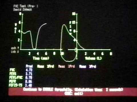 RESPIRATORY CARE: FVC Graphics.wmv - YouTube