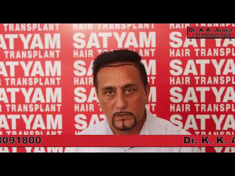 Dilbar Kang (Omni TV) Successful Hair Transplant in Ludhiana At Satyam ...