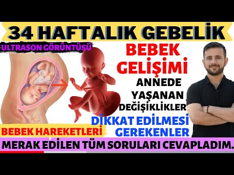 34 Haftalık Gebelik (2025)