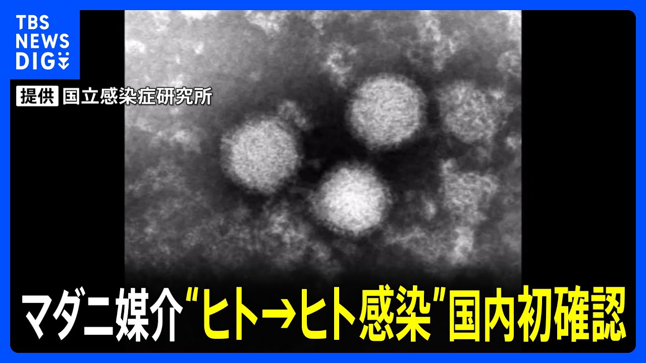 患者→医師への“ヒト→ヒト感染”国内初確認 マダニ感染症「SFTS」国立感染症研究所は注意呼びかけ｜TBS NEWS DIG - YouTube