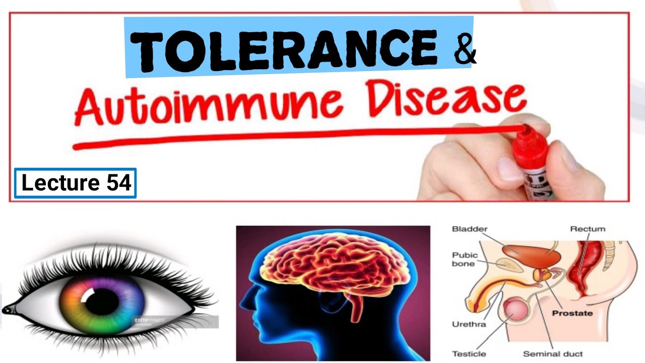Tolerance & Autoimmune diseases || Lecture 54 - YouTube