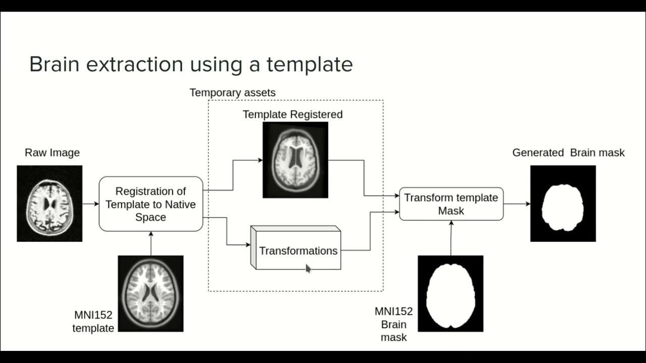 9.0 - MRI brain extraction using a template - Course MRI preprocessing with Python - YouTube