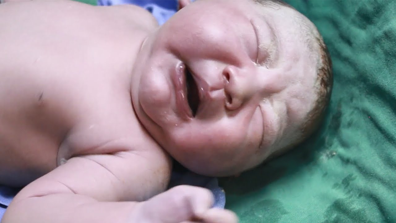 Childbirth - Normal Delivery| LIVE BIRTH VLOG | C-SECTION DELIVERY IN ...