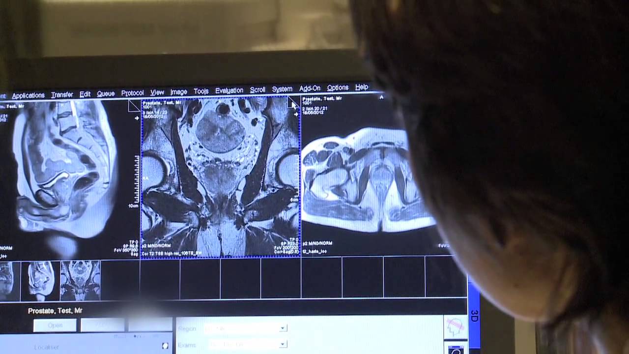 Precision Prostate Diagnostics - YouTube