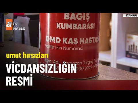 SMA’lı çocuğun parasına çöktü  - atv Haber 18 Nisan 2025