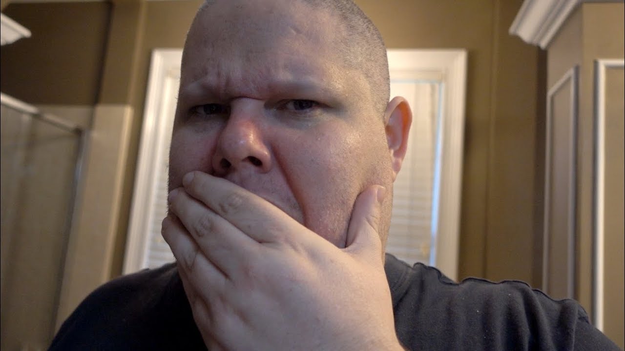 Angry Man With No Eyebrows