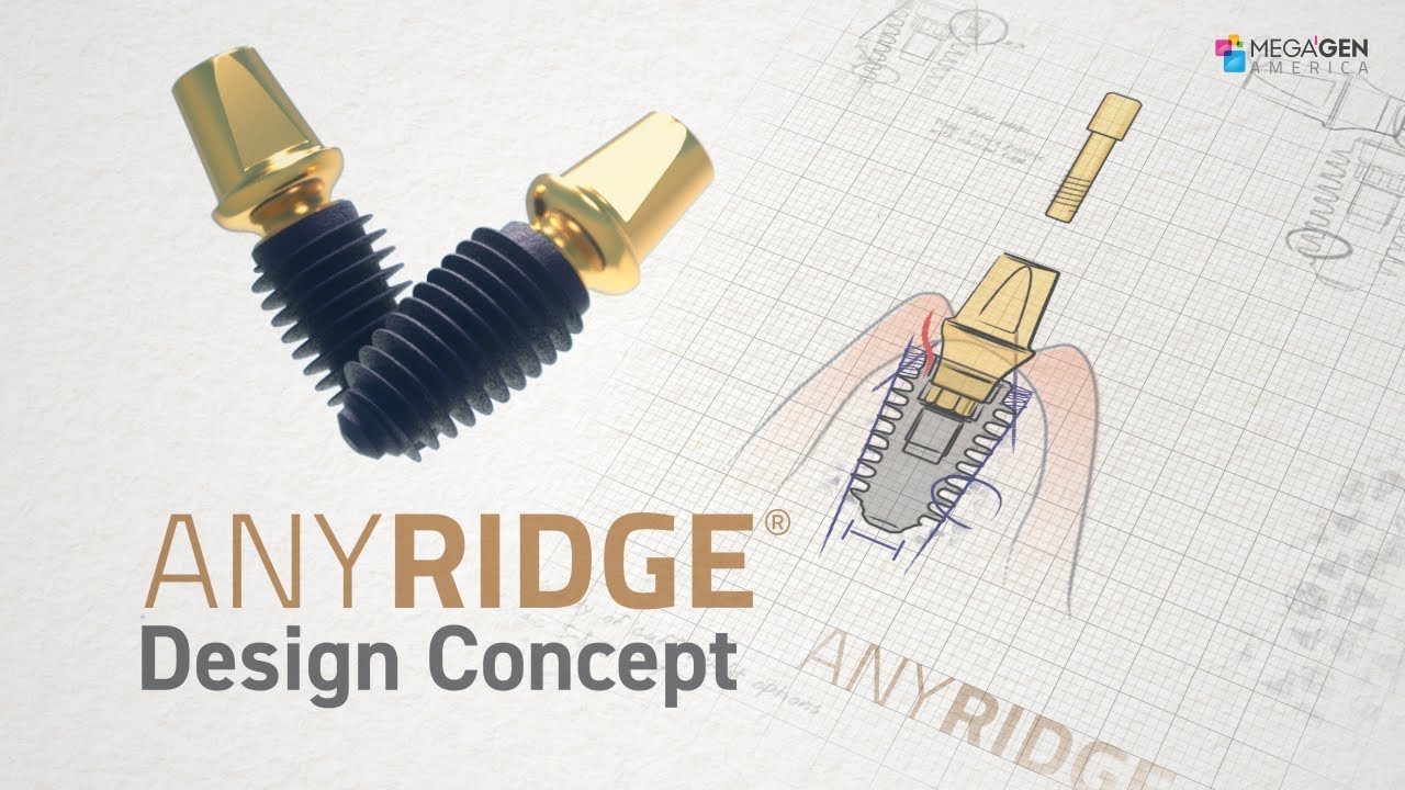 AnyRidge Design Concept - YouTube