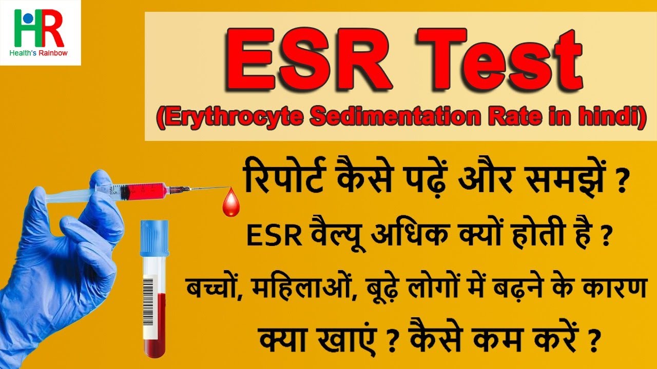 ESR Test In Hindi ESR Blood Test ESR ESR esr-test-in-hindi-esr-blood-test-esr-esr
