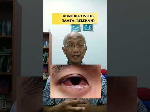 Konjungtivitis (Mata Belekan)| dr. Basuki Rokhmad