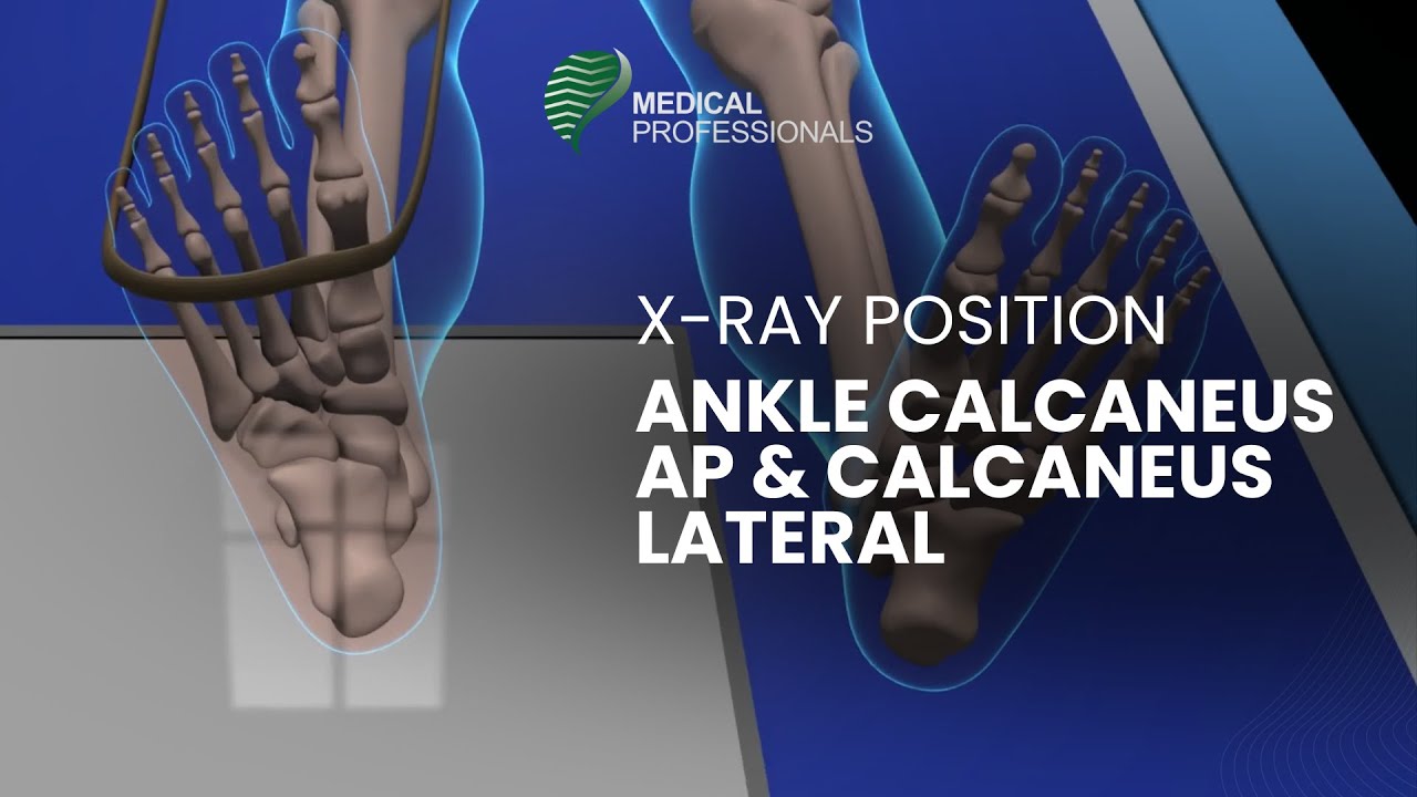 Ankle Calcaneus AP and Calcaneus Lateral X-ray Positioning Guide - YouTube