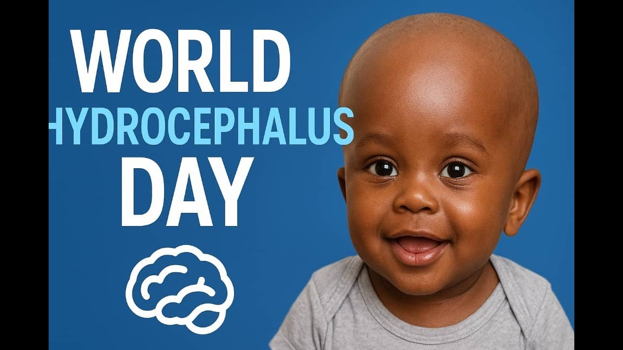 World Hydrocephalus Day 2025: Life-Changing Facts You Need to Know ...