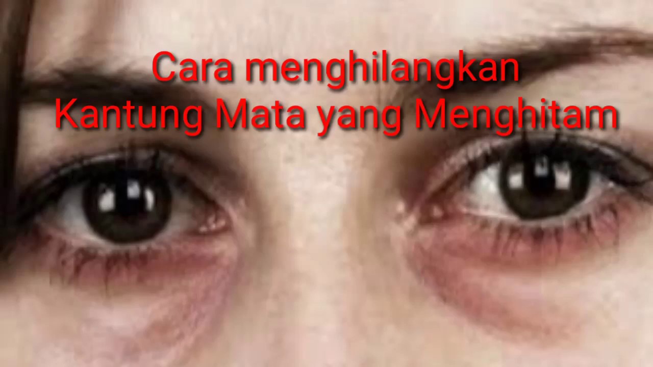 Cara Menghilangkan kantong mata yang menghitam - YouTube