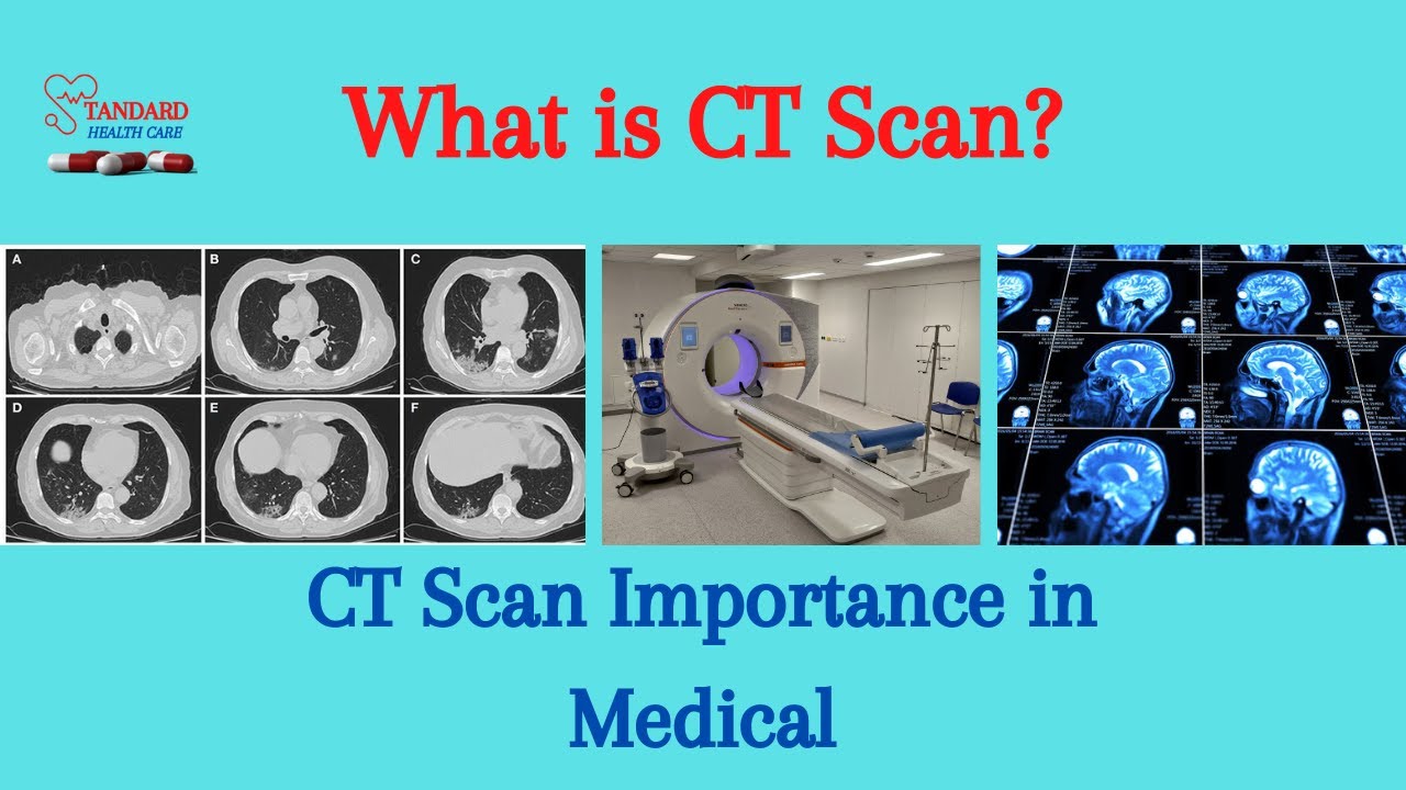 What is CT Scan ? CT Scan Importance in Medical || Computed Tomography ...
