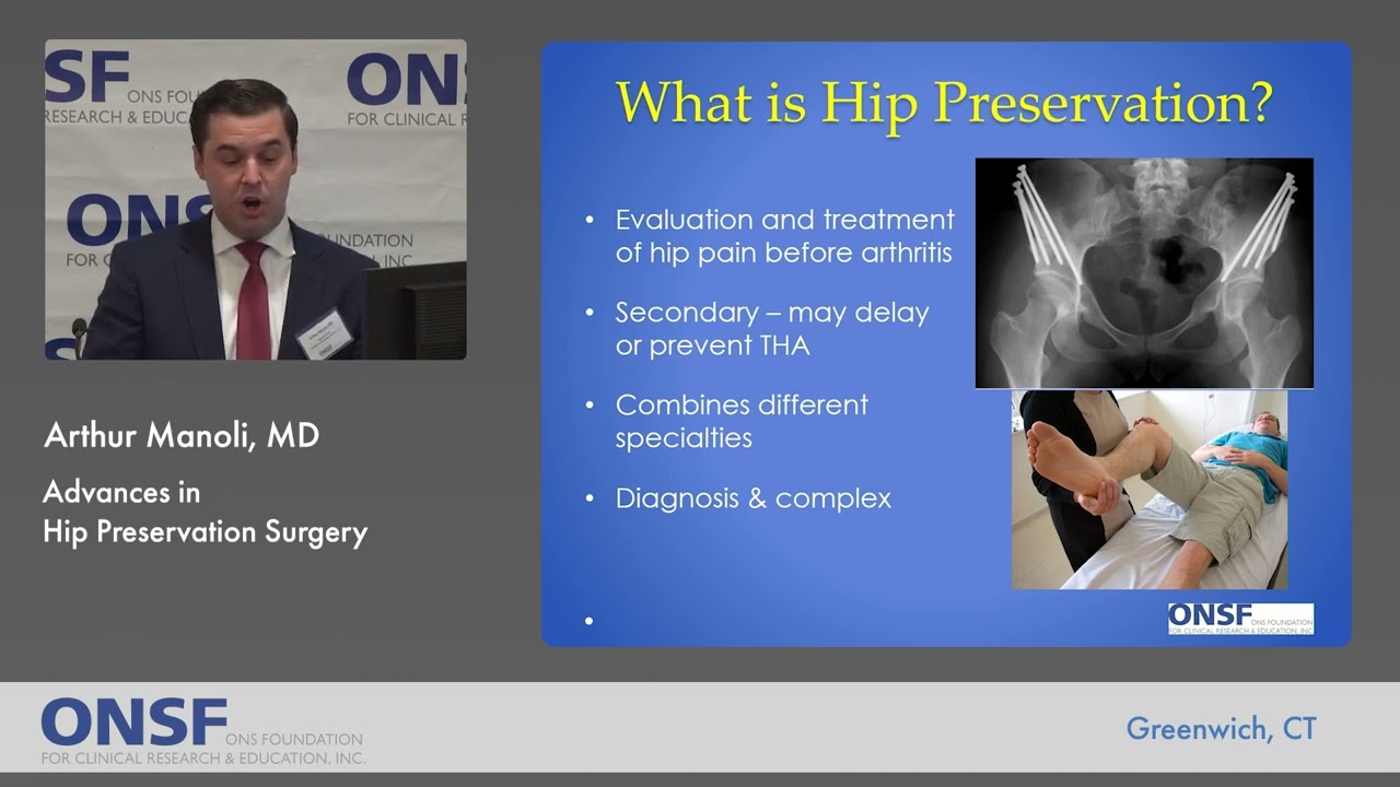 ONSF2022 08 Advances in Hip Preservation Surgery Arthur Manoli MD - YouTube