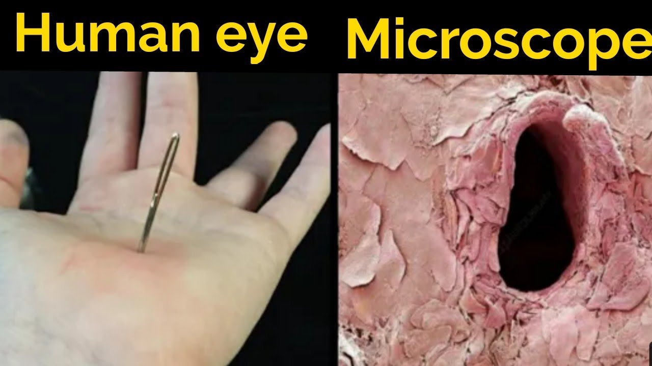 9 things you canot see without microscope|microscope ke ander nazar ane ...
