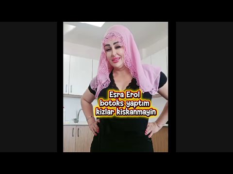 Botoks yaptım nasıl güzel olmusmuyum 