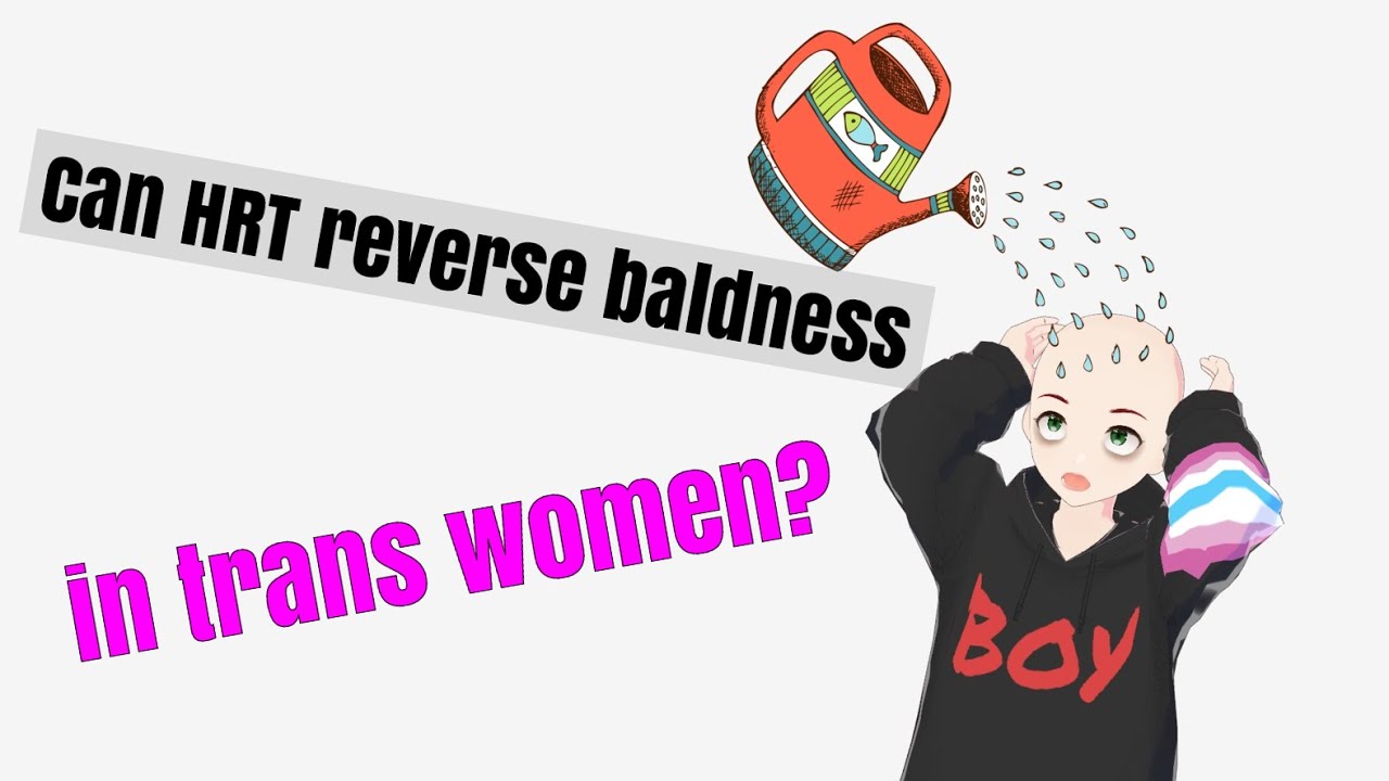 Can HRT reverse baldness? | #Transgender - YouTube