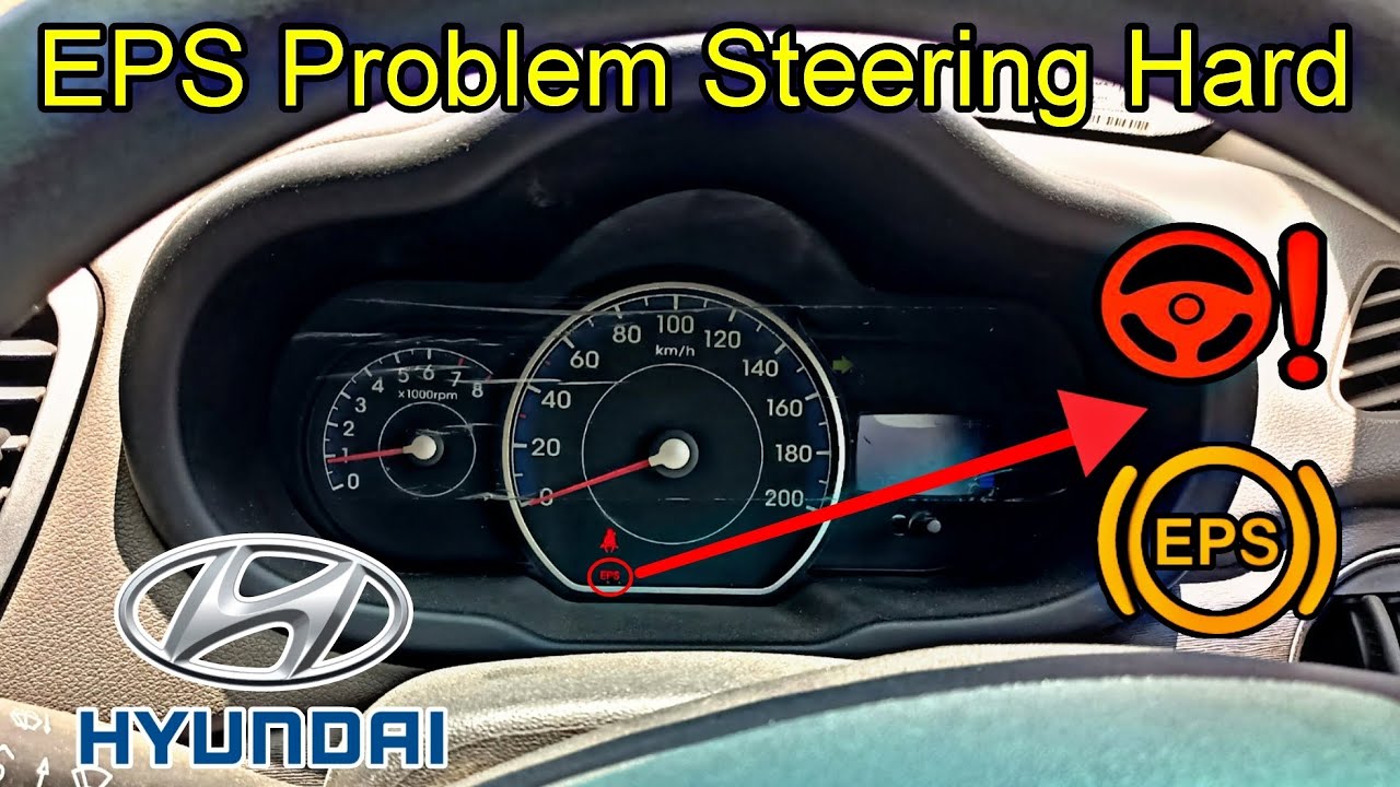 How To Solve Eps Problem In Car