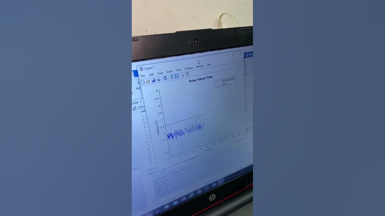 Demo Presentation Video for project IOT-BLOOD PRESSURE MONITORING ...