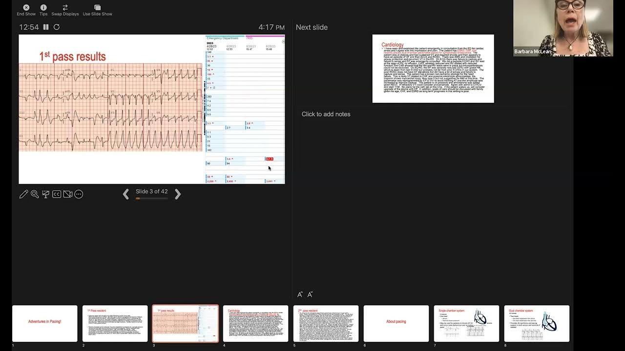 Adventures in Pacing - YouTube