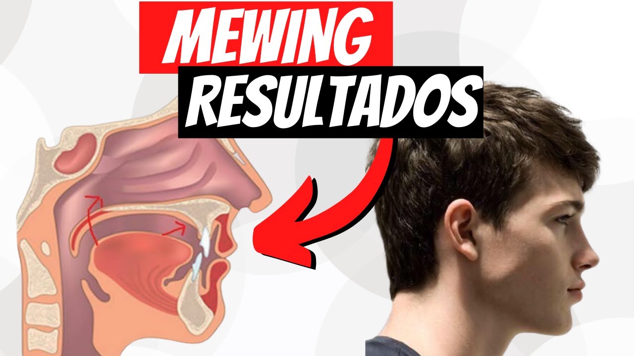 MEWING Resultados | ¿CUÁNTO TARDA? - YouTube