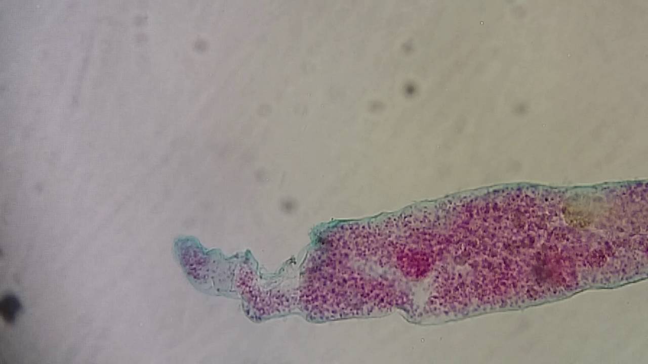 Redia of Fasciola hepatica - YouTube