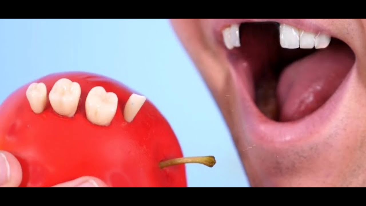 My Reaction to Jessie and Mike: Teeth Stuck in Apple - YouTube