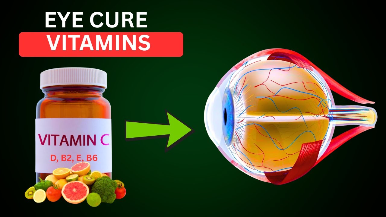 Top 6 Vitamins to Improve Vision Naturally#food #facts # ...