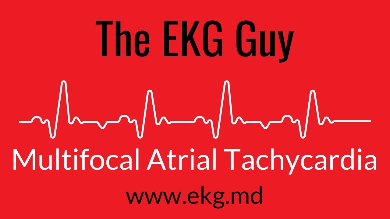Multifocal Atrial Tachycardia EKG l The EKG Guy - www.ekg.md - YouTube