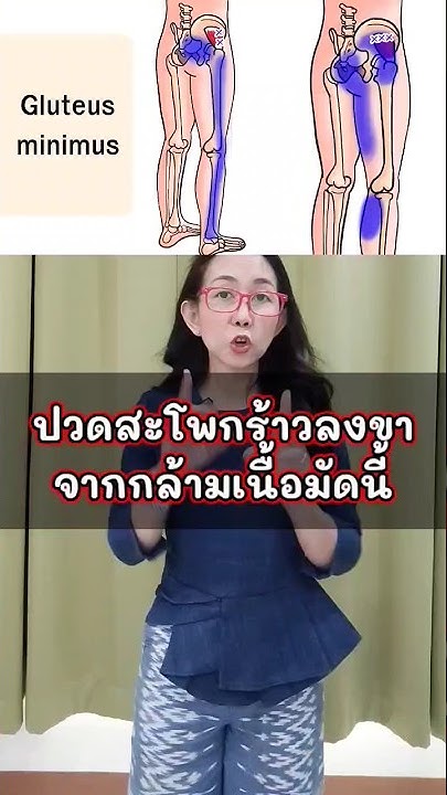 ปวดสะโพกร้าวลงขา จากกล้ามเนื้อมัดนี้ ปวดอะไรก็หายได้byกภขวัญหญิง โทร
