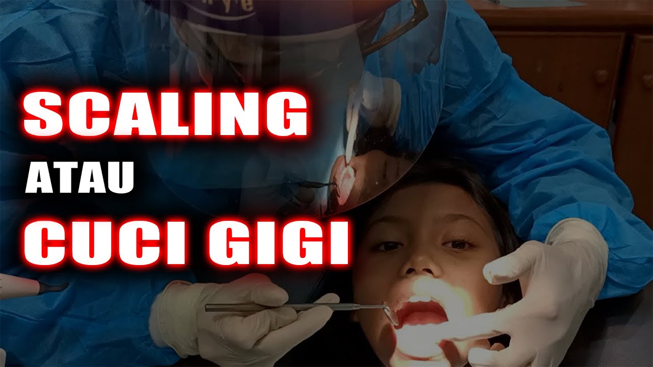 Scaling atau Cuci Gigi Yang Terbaik - YouTube
