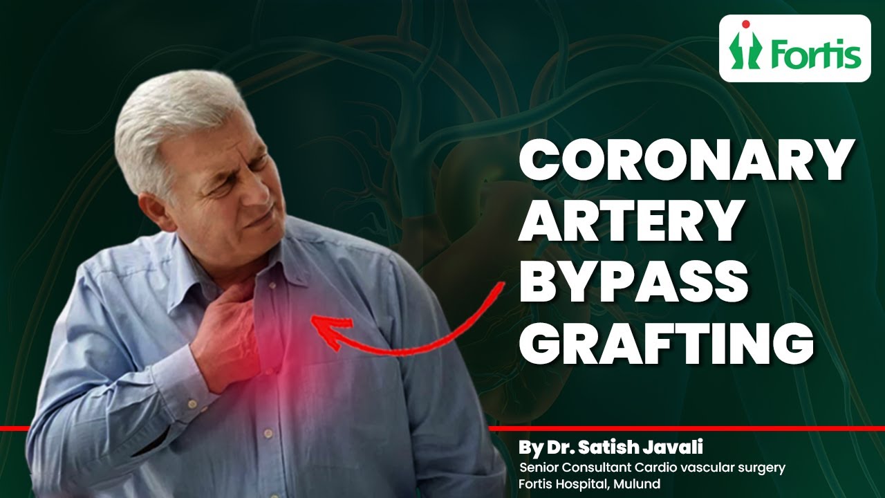 What Is Coronary Bypass Graft? | Heart Blockage Treatment | Angiography ...