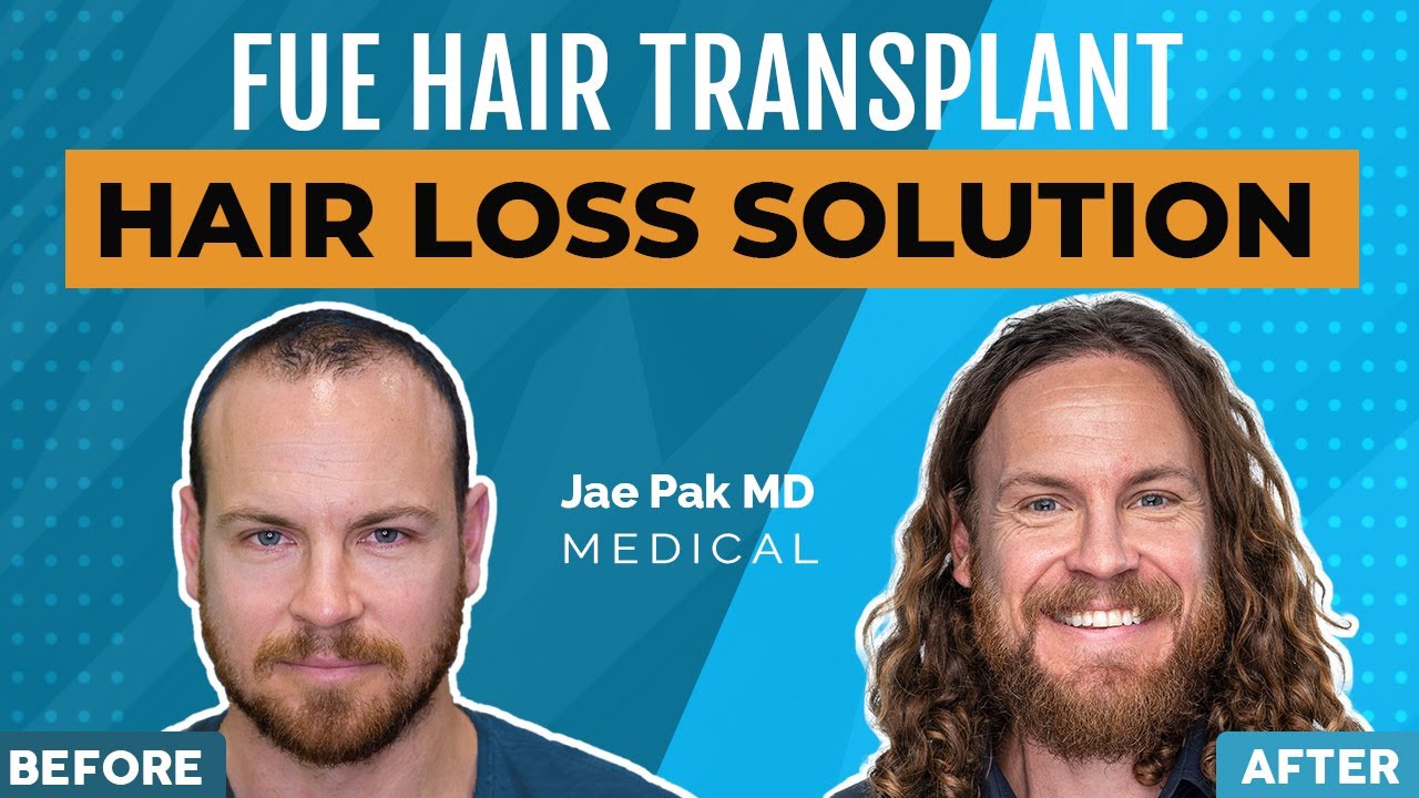 FUE Hair Transplants - Jae Pak MD Medical - YouTube
